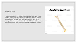 Type of Fracture MSK Radiology- Redo.pptx