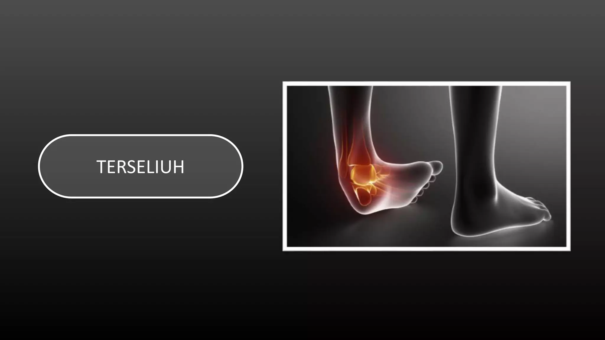 Jenis Kecederaan Ringan | PPTX