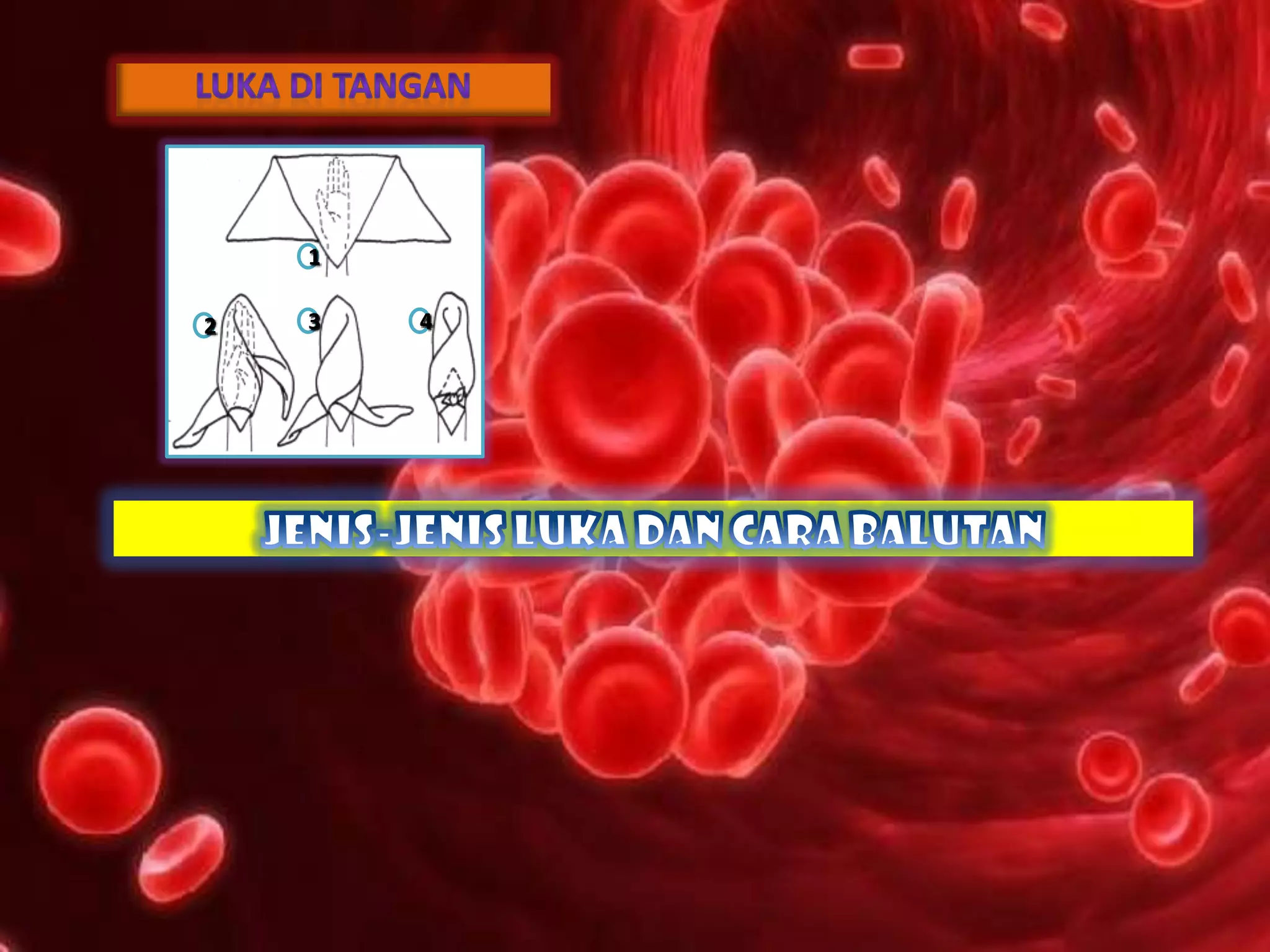 Jenis jenis luka dan cara balutan | PPTX