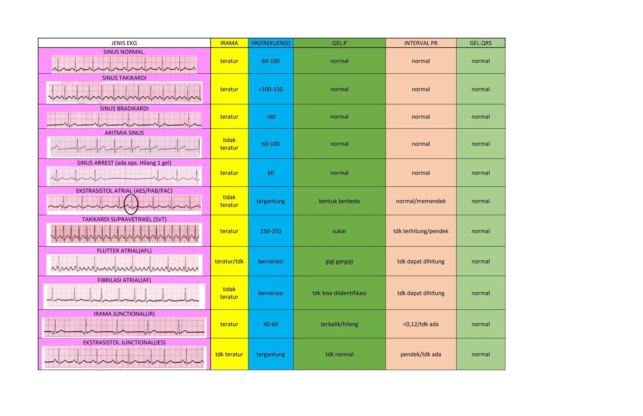 THE TYPES OF ELECTROCARDIOGRAPHY OF HUMAN | PDF