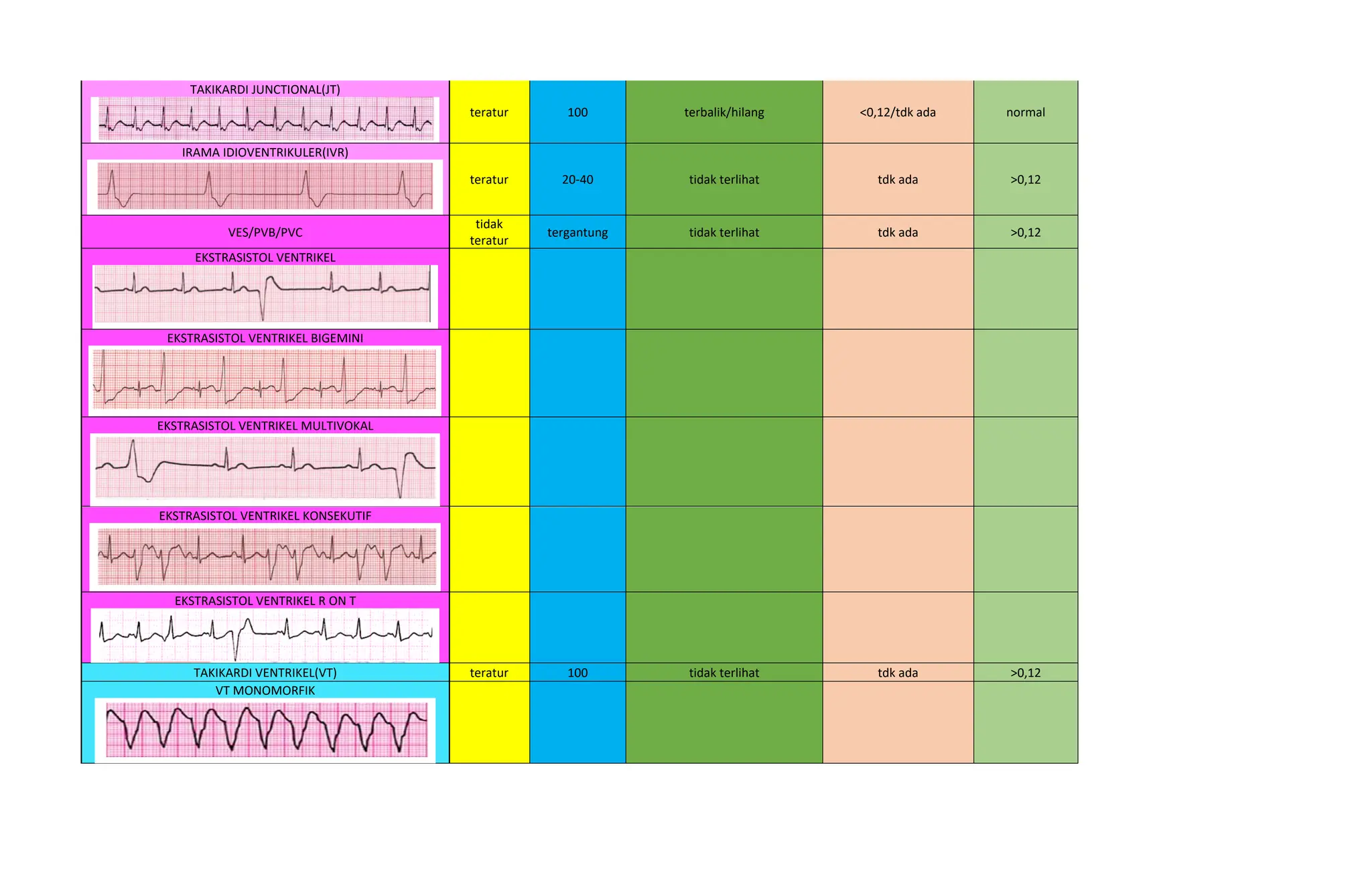 THE TYPES OF ELECTROCARDIOGRAPHY OF HUMAN | PDF