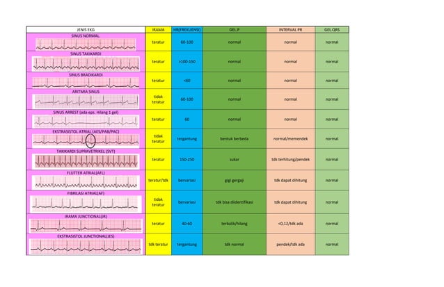 THE TYPES OF ELECTROCARDIOGRAPHY OF HUMAN | PPT