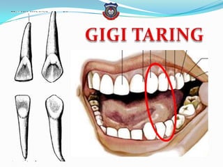 Jenis gigi | PPTX