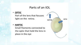 JENIS INTRAOCULAR LENS............................ | PPT