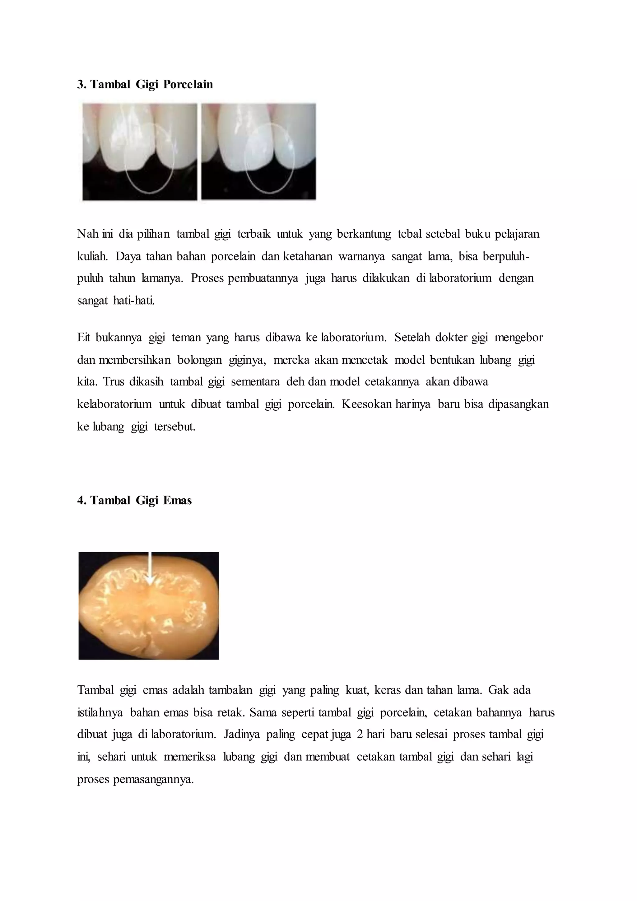 Jenis jenis penambalan gigi | DOCX