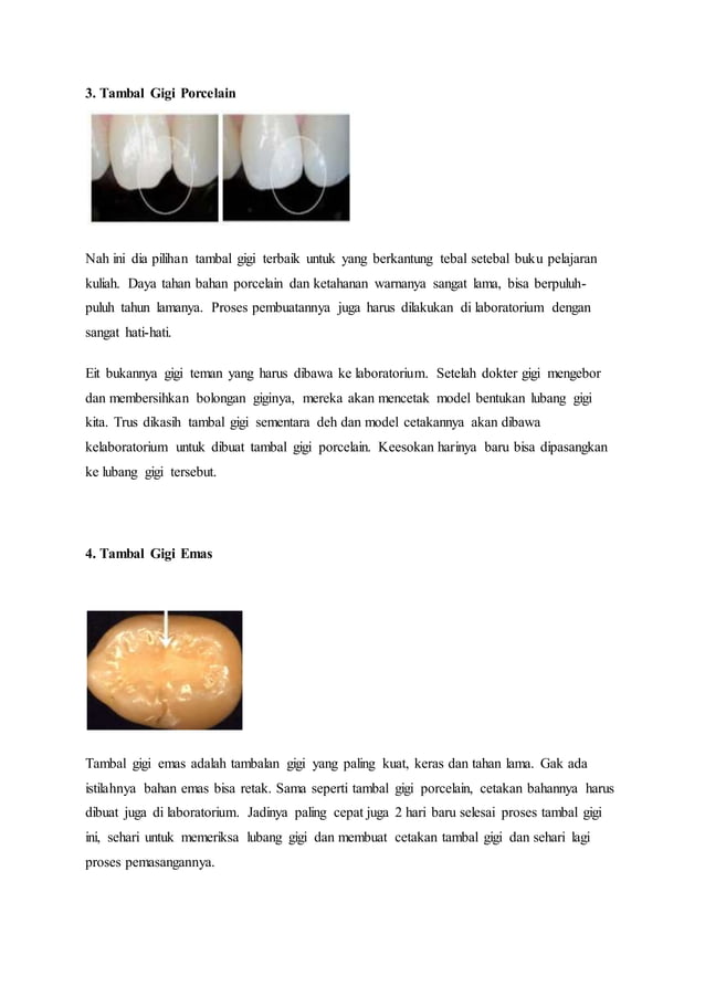 Jenis jenis penambalan gigi | DOCX