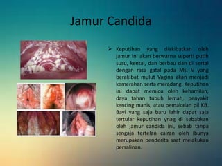 Jenis jenis penyakit infeksi | PPT