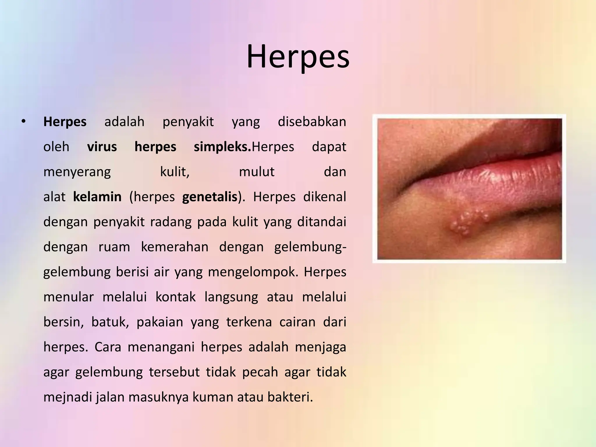 jenis jenis penyakit infeksi di sekitar kita | PPTX