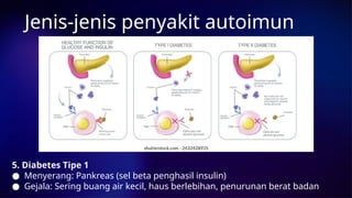 JENIS PENYAKIT IMUNNOLOGI KLINIKKKK.pptx