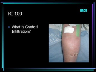 Jeopardy Game - Peripheral IV Therapy | PPT