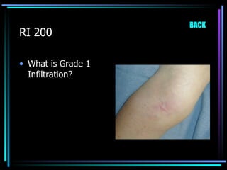 Jeopardy Game - Peripheral IV Therapy | PPT