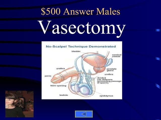 Jeopardy Sex Education Edition1 Ppt Birth Control Reproductive Health