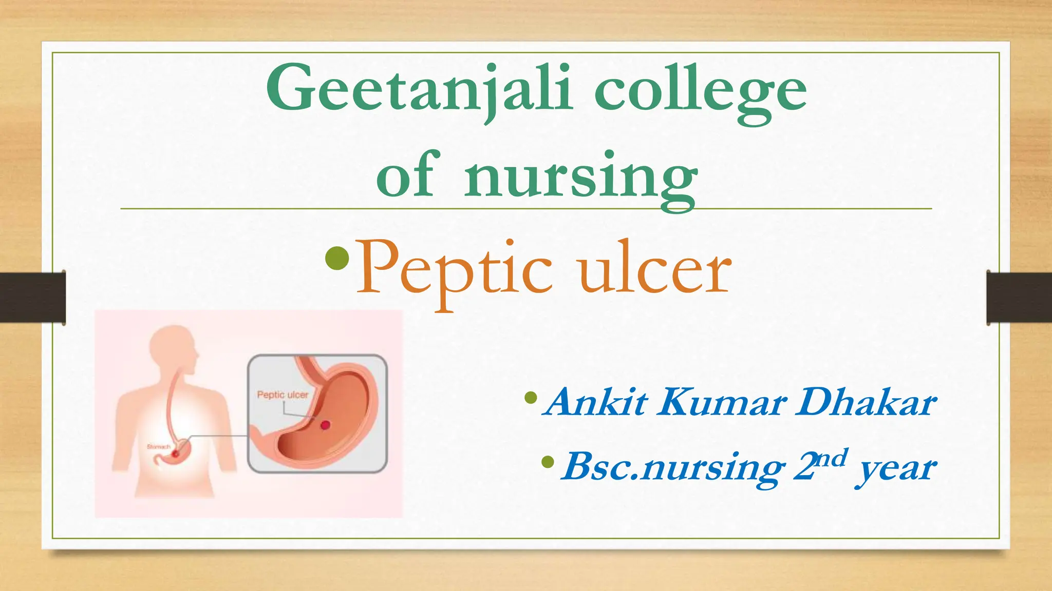 Peptic ulcer | PPT