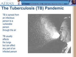 HIV/AIDS & TB | PPT