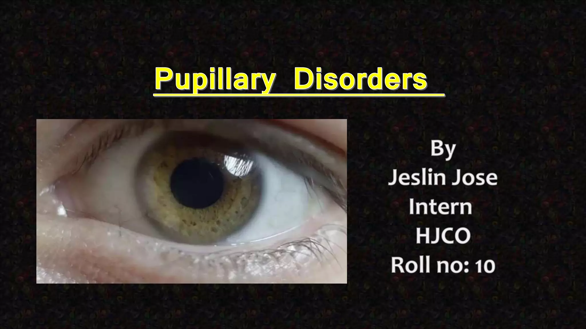 PUPIL AND ITS DISORDERS | PPT