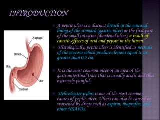 PEPTIC ULCER | PPT
