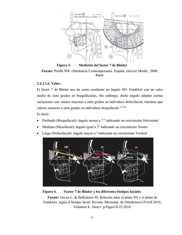 JESSICA MARIBEL YANEZ NUGRA- Ortodoncia | PDF