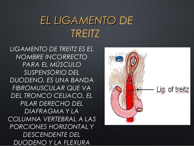 Ligamento De Treitz