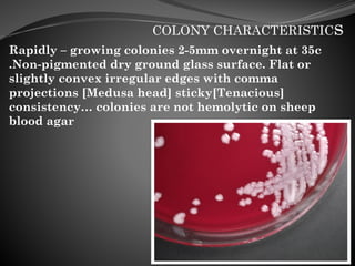 bacillus anthracis [ anthrax ] | PDF | Infectious Diseases | Diseases ...