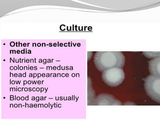 bacillus anthracis [ anthrax ] | PDF | Infectious Diseases | Diseases ...