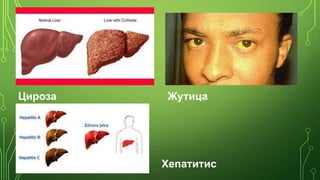 Јетра - Н. Марчетић | PPT