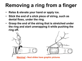 Jewelry safety | PPTX