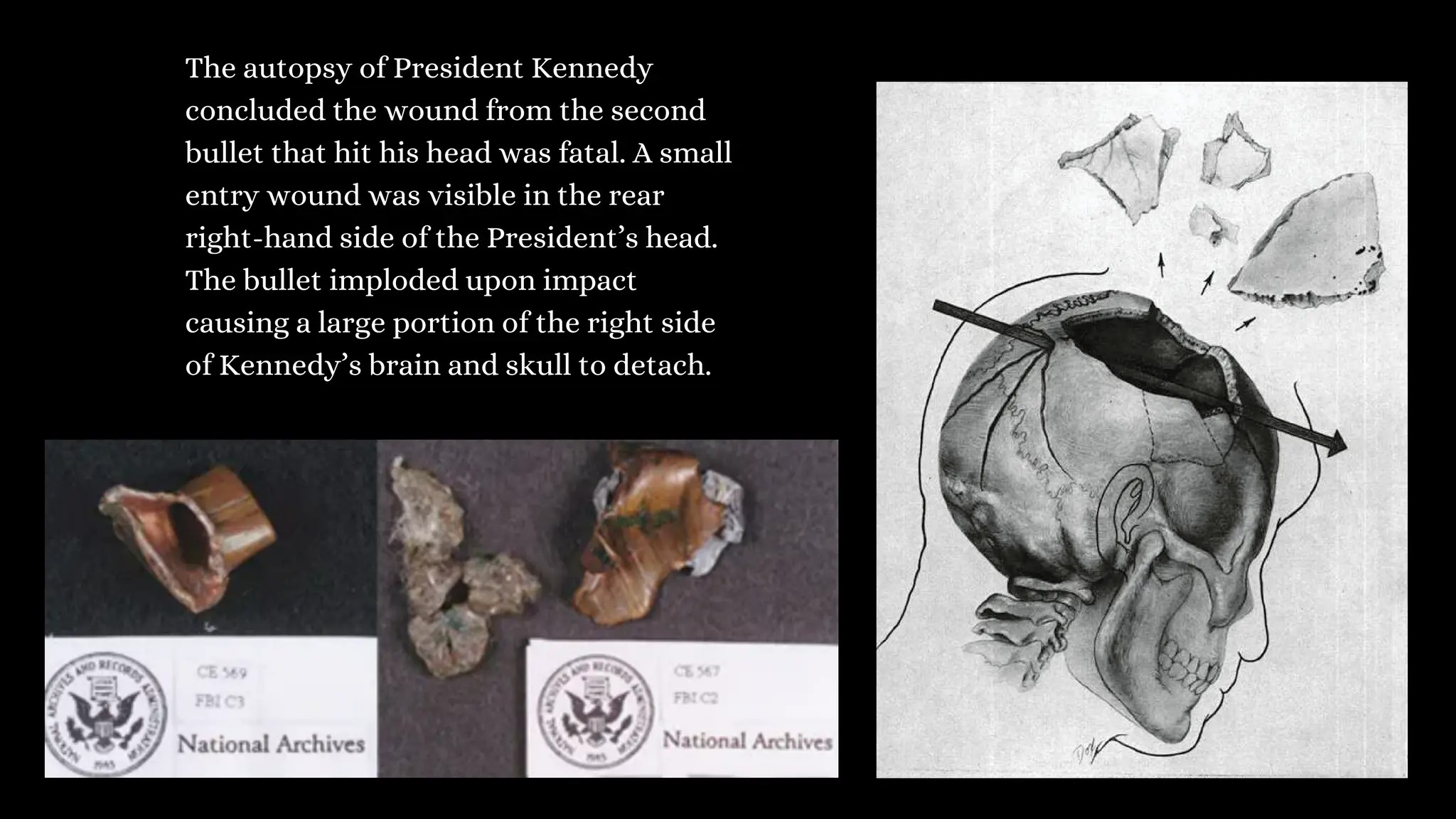 John F Kennedy Assassination- As a Forensic Ballistics Case Study | PDF
