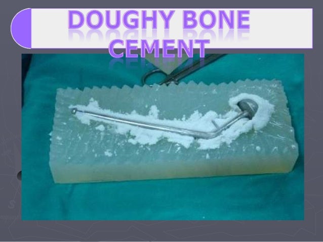 Antibiotic Cement Spacer for Infected Hip Joint Replacement (THR) Sur…