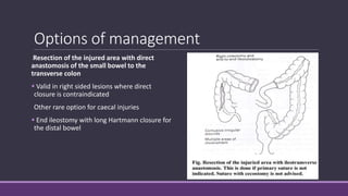 Colorectal injuries | PPTX