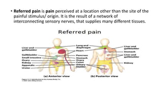 A chart of pic showing referred pain | PPT