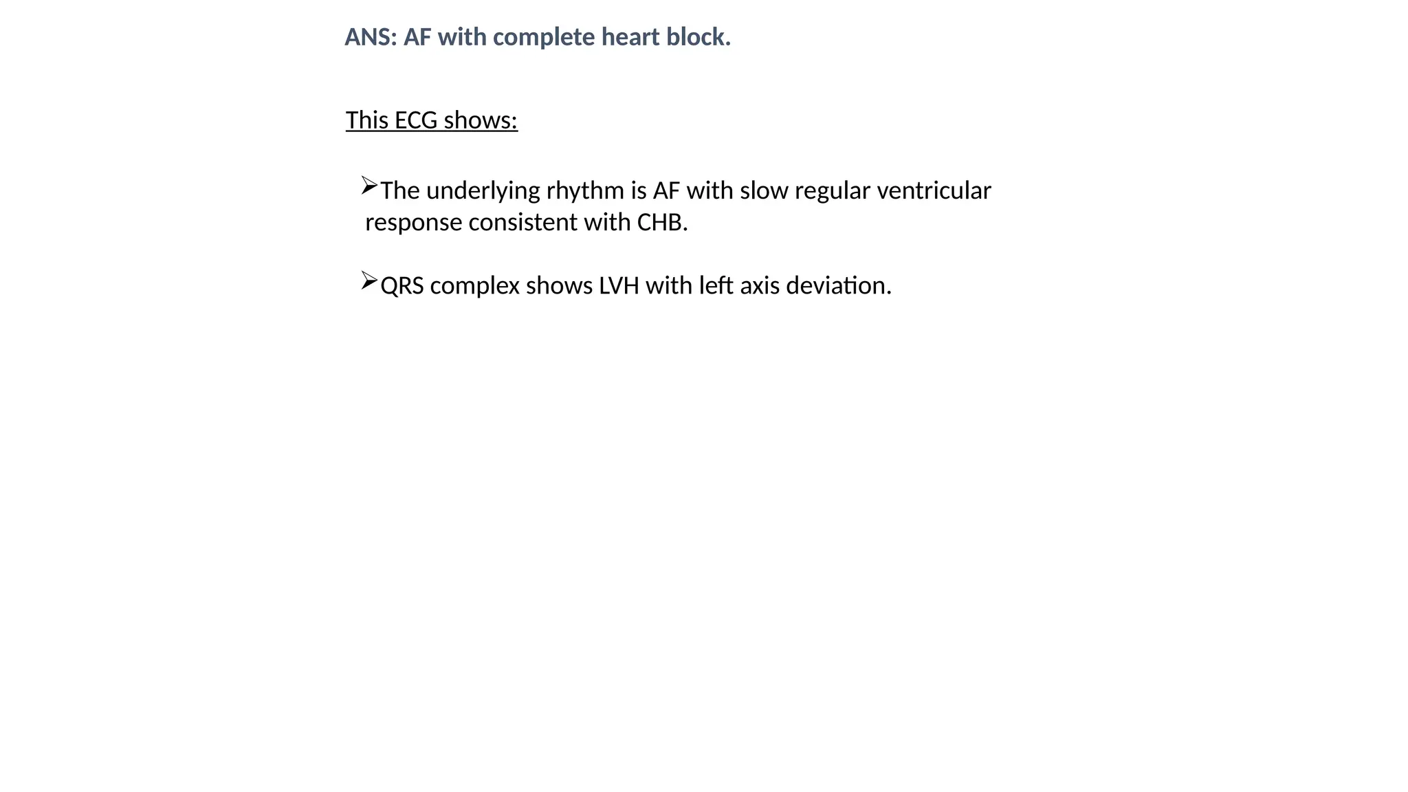 ecg on BRADYCARDIA sinus node dysfunction av block | PPTX