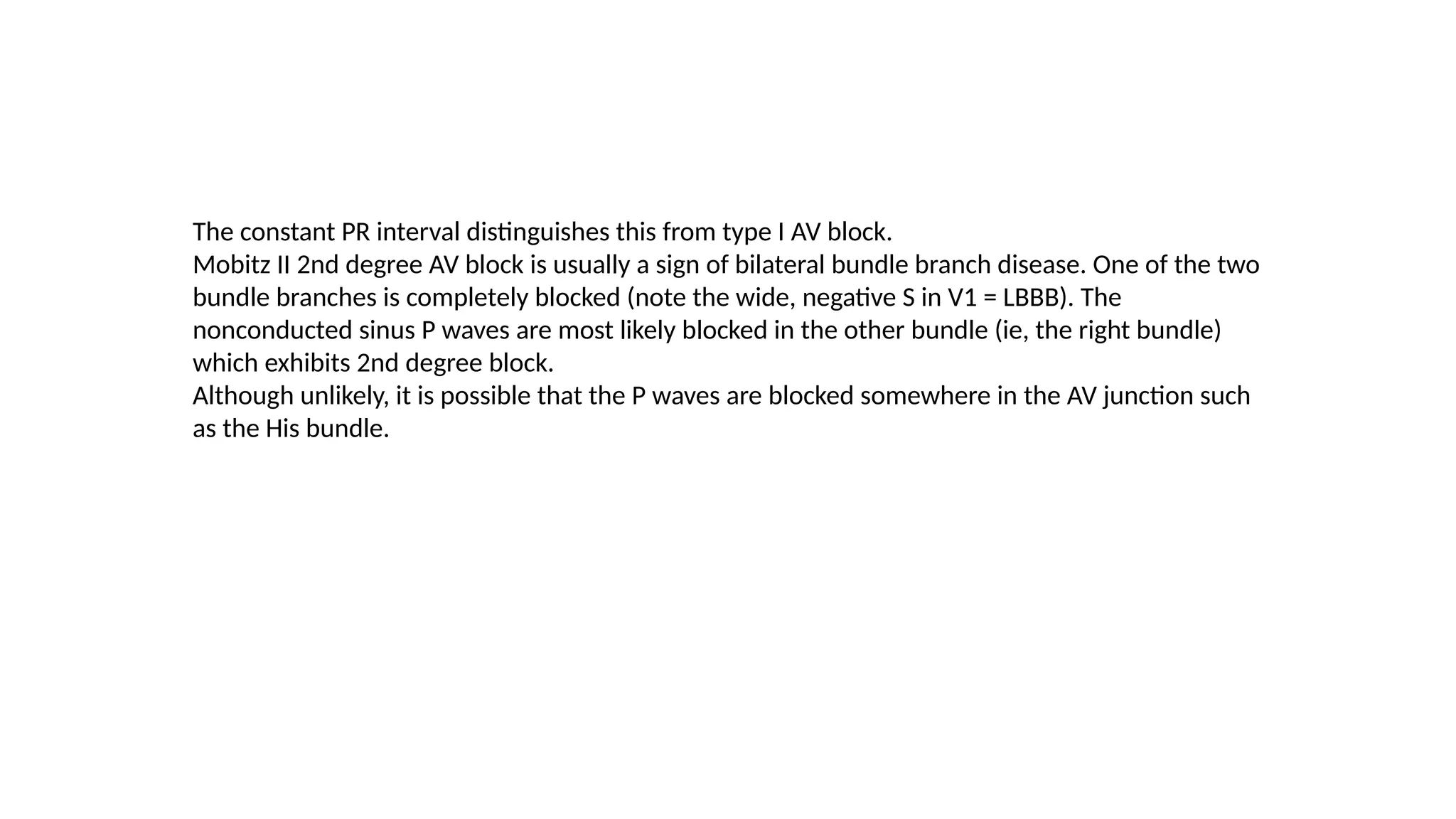 ecg on BRADYCARDIA sinus node dysfunction av block | PPTX