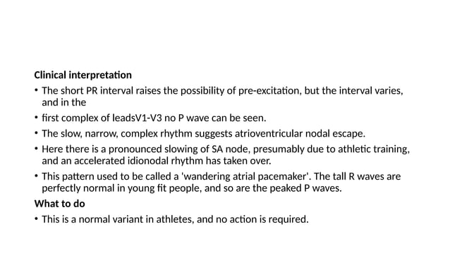 ecg on BRADYCARDIA sinus node dysfunction av block | PPT