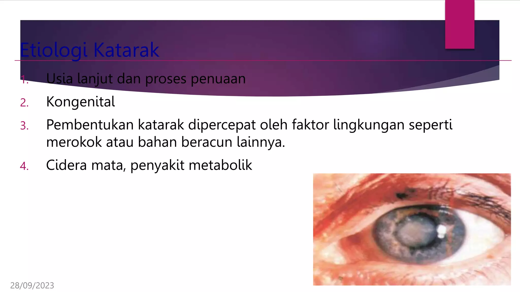 KATARAK.pptx