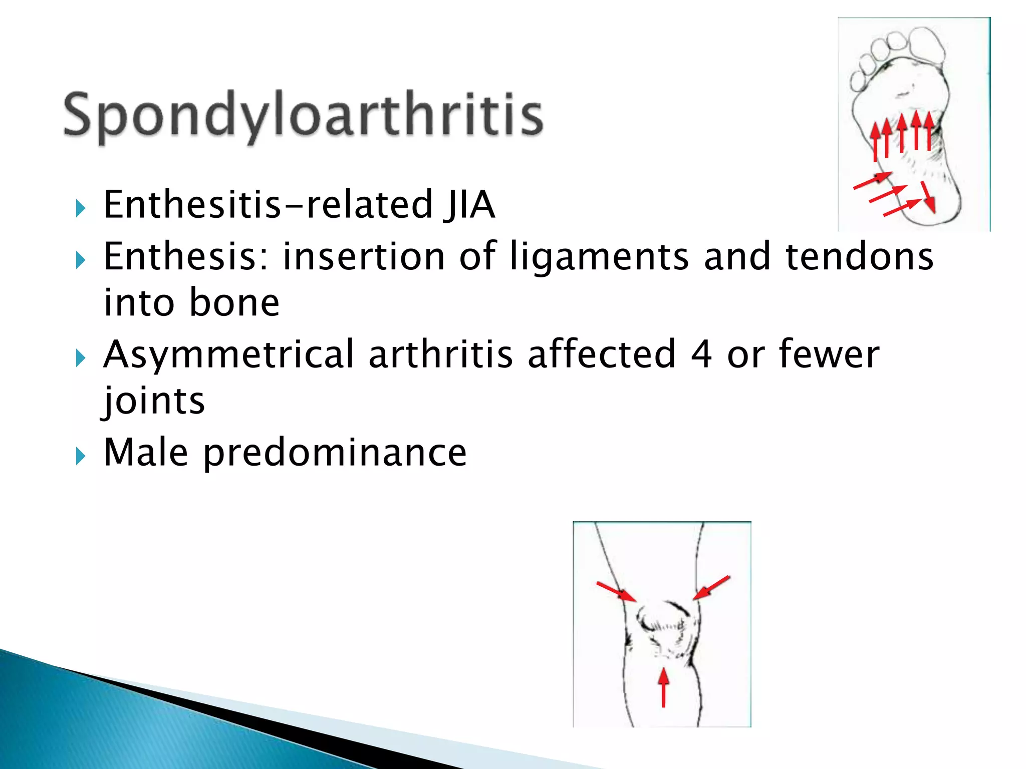 Juvenile Idiopathic Arthritis | PPTX