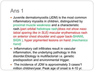 JUVENILE IDIOPATHIC ARTHRITIS IN CHILDREN | PPTX