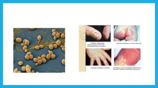 Jigsaw reading | PPT