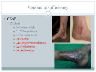 Venous Thromboembolic Disease and Current Management | PPT