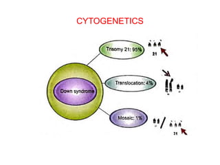 Down Syndrome Diagram