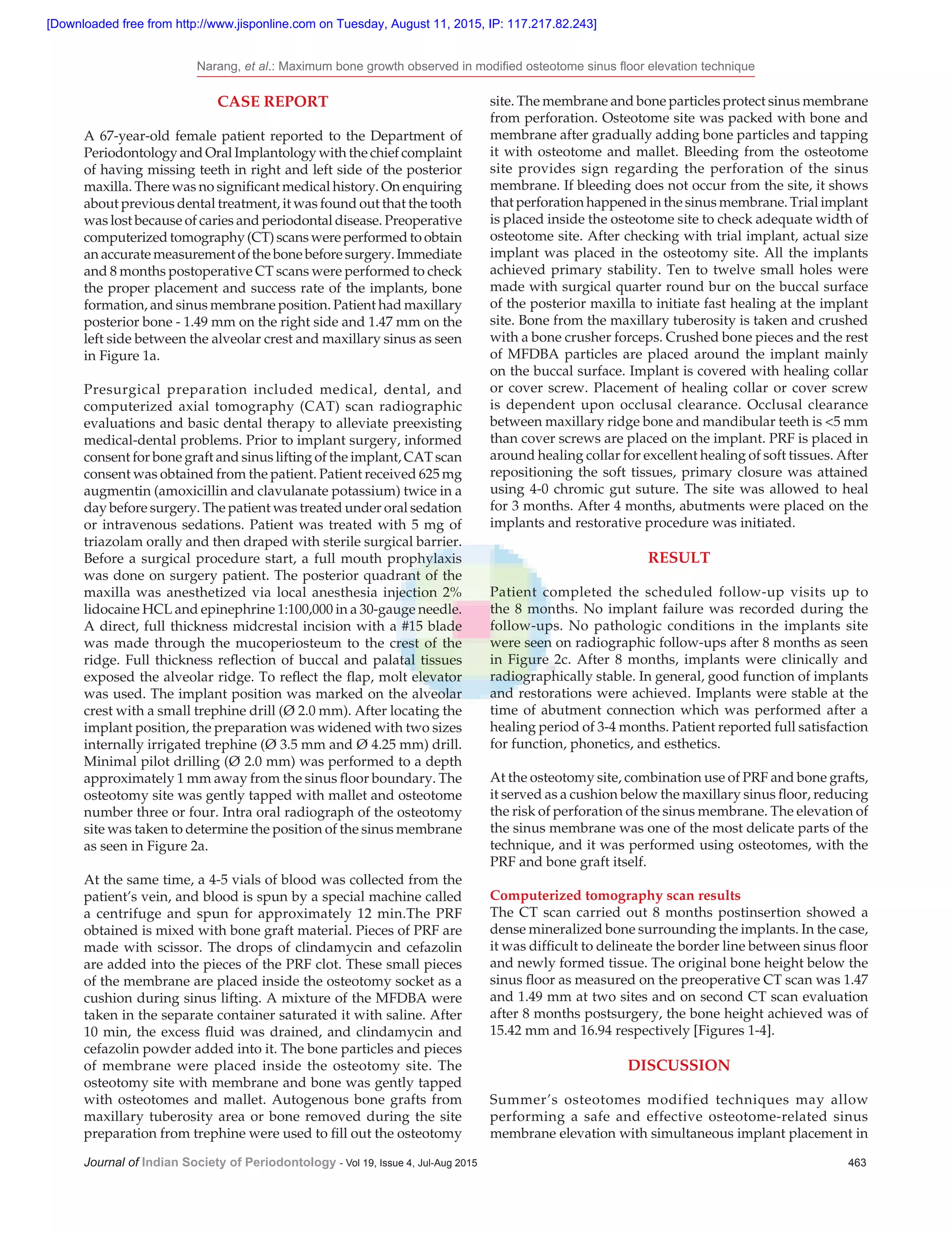 Modified osteotome sinus floor elevation by using combination PRF ...