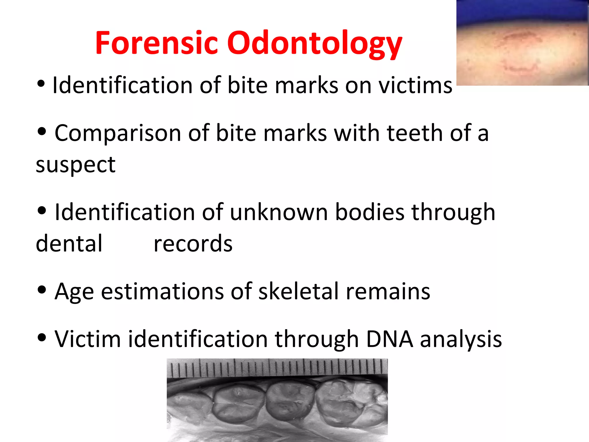 identification of Race in Forensic medicine | PPT