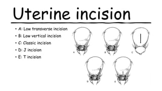 Indication_of_cesarean_section.pptx | Free Download