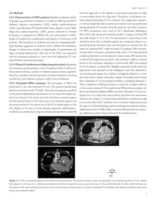 Efficacy and Safety of Computed Tomography-guided Radiofrequency ...