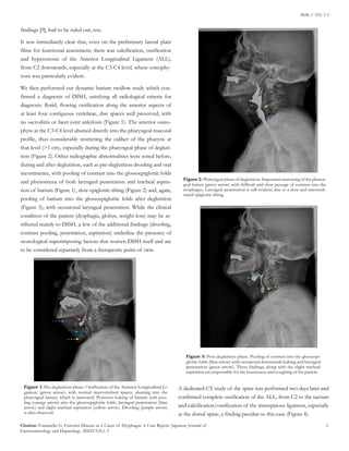 Forestier Disease as a Cause of Dysphagia: A Case Report | PDF