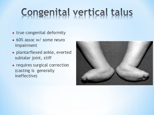 Orthopedic problems in neonates