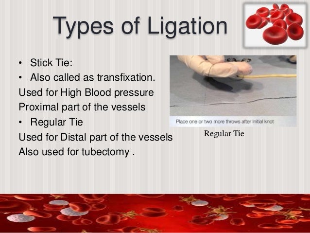 Hemostasis