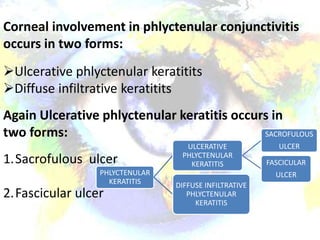 Phlyctenular Keratitis