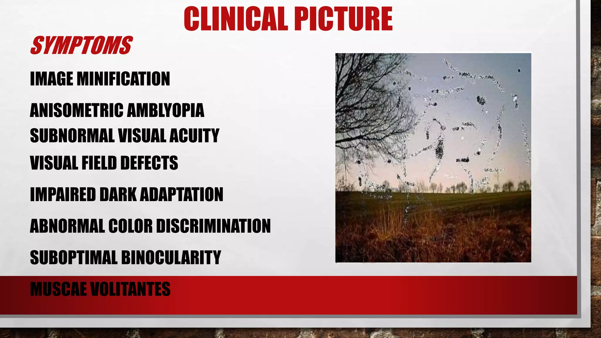 Pathological Myopia | PPTX