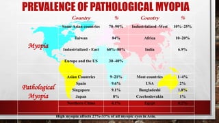 Pathological Myopia | PPTX