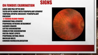 Pathological Myopia | PPTX